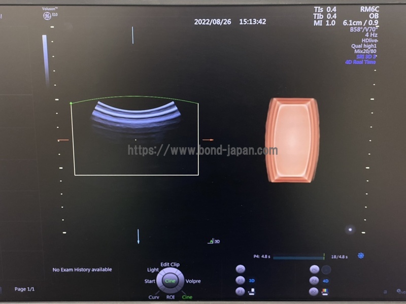Product Information｜GE｜4D Ultrasound｜17459｜Used and Refurbished Medical ...