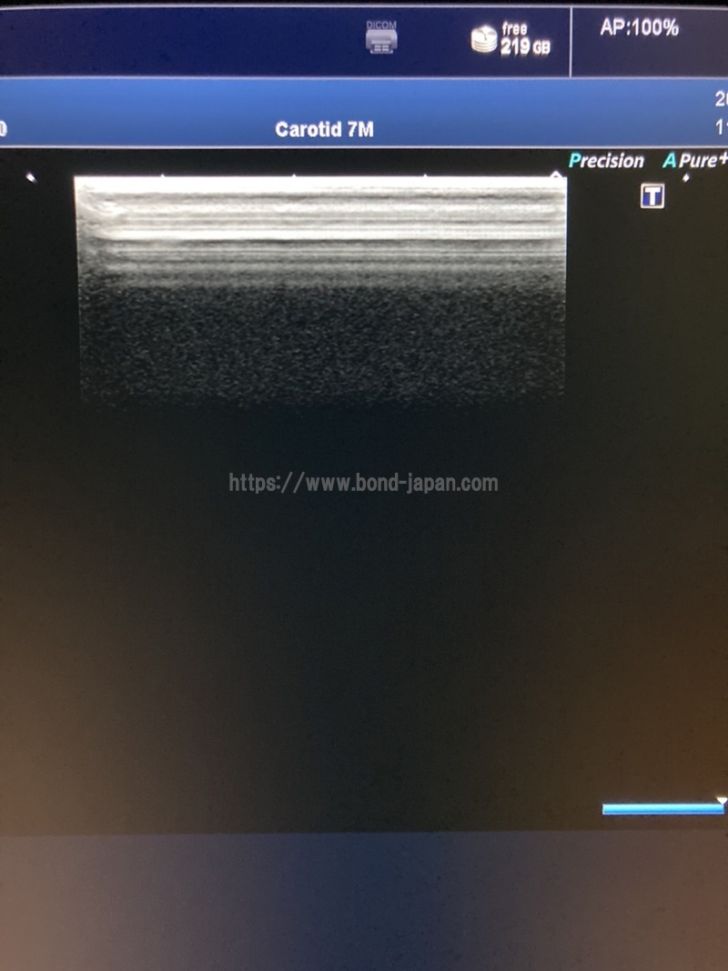 Product Information｜CANON｜Color Doppler｜17690｜Used and Refurbished ...